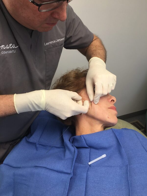 Silhouette Thread Lift | Non Surgical Facelift at Sonata | Broomfield, CO